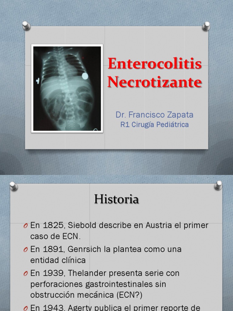 Entendiendo la Enterocolitis Necrotizante: Una Revisión Histórica ...