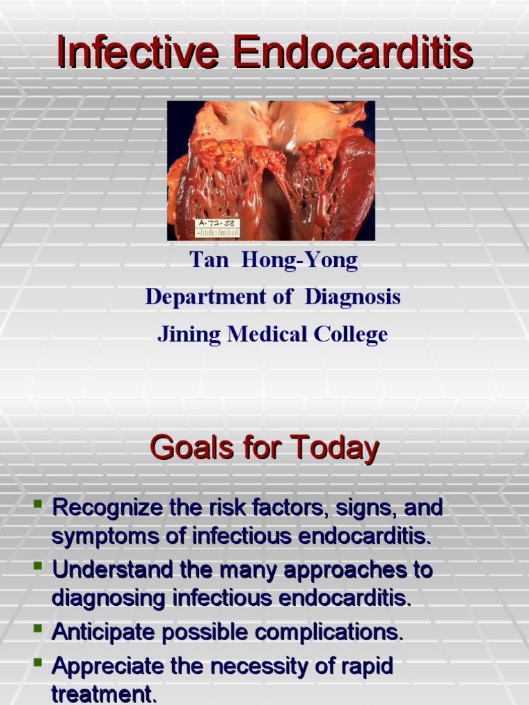 Infective Endocarditis Signs