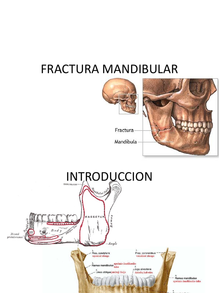 FX Mandibular | PDF | Ciencia y matemáticas