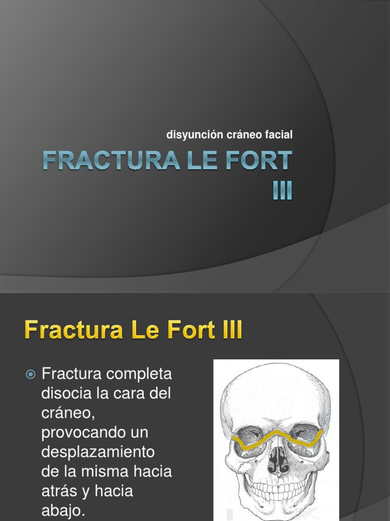 Fractura Le Fort III: Características y Tratamiento | PDF | Deportes y ...