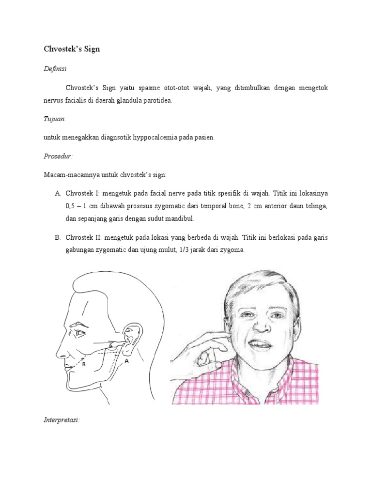 Chvostek S Sign | PDF | Sains & Matematika