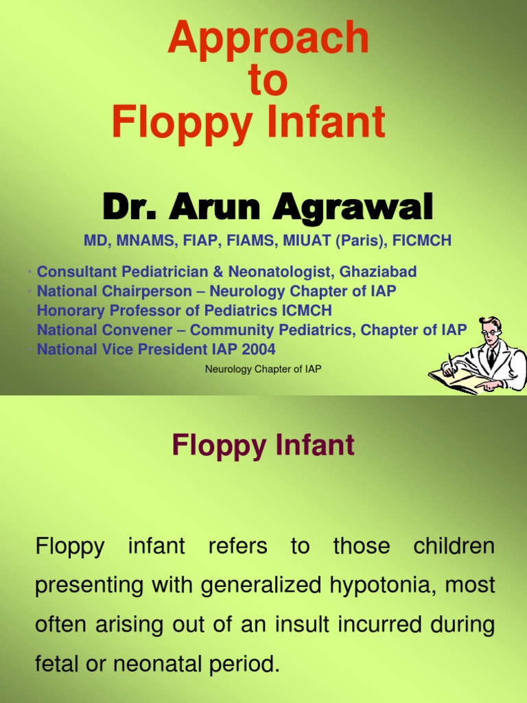 Approach To Floppy Infant | PDF | Weakness | Electromyography