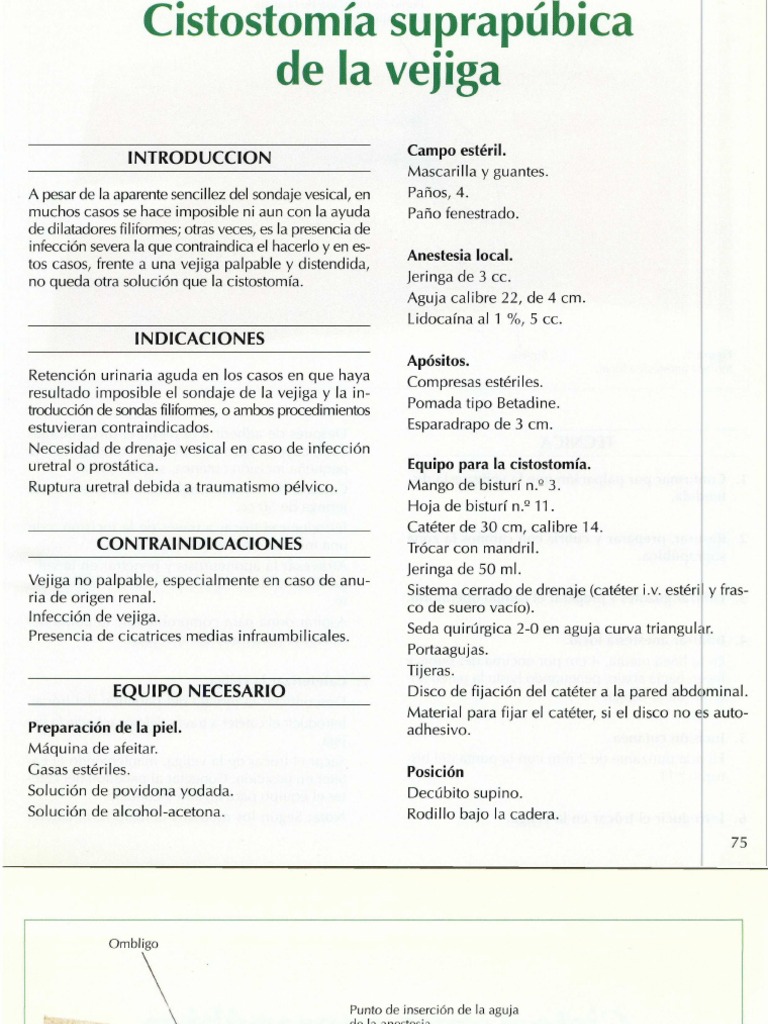 Talla Vesical o cistostomía suprapúbica | PDF | Vejiga urinaria | Urología