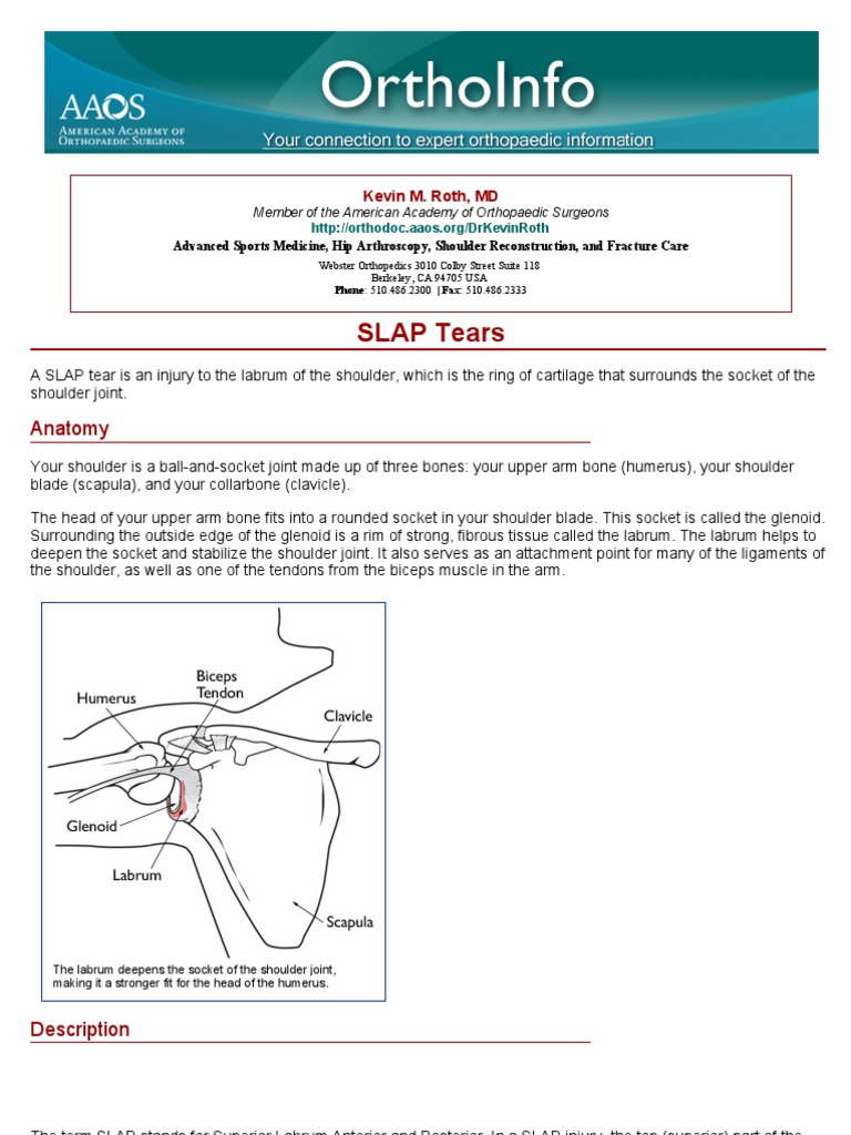 Slap Tears-Orthoinfo - Aaos | PDF | Shoulder | Arm