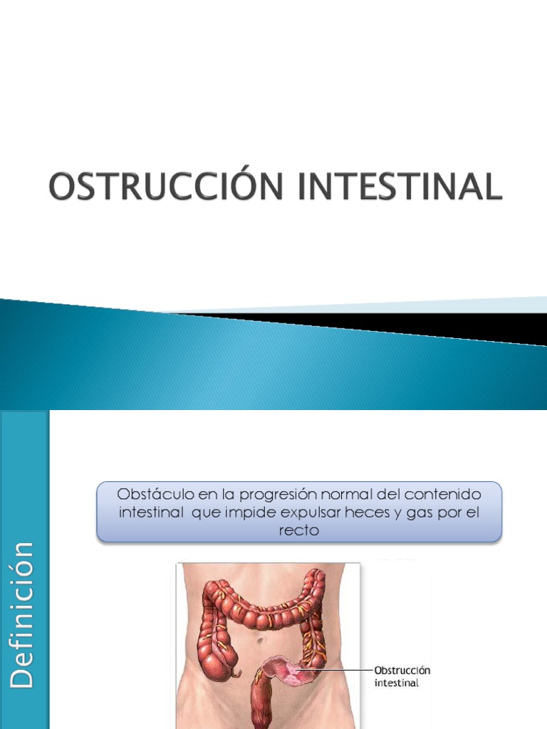 Clasificación y manejo de obstrucción intestinal | PDF ...