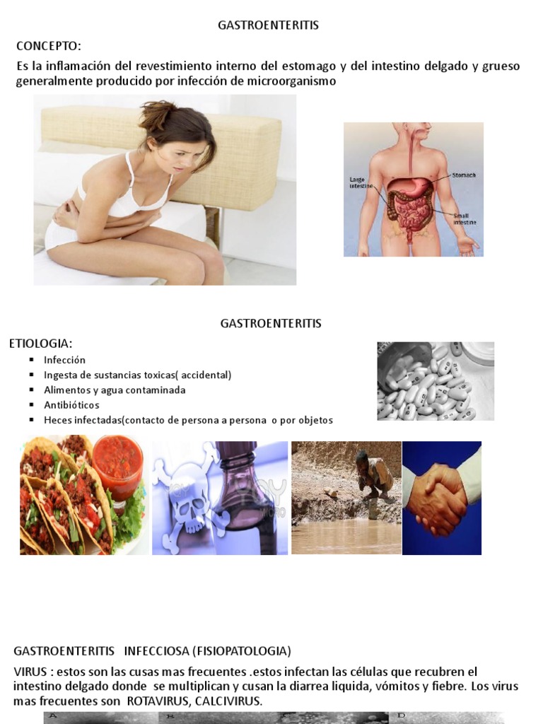 Gastroenteritis | Diarrea | Inmunología