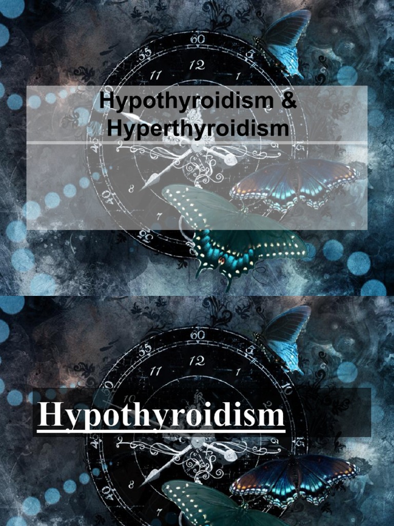 Pathophysiology of Hyperthyroidism | Download Free PDF | Hypothyroidism ...