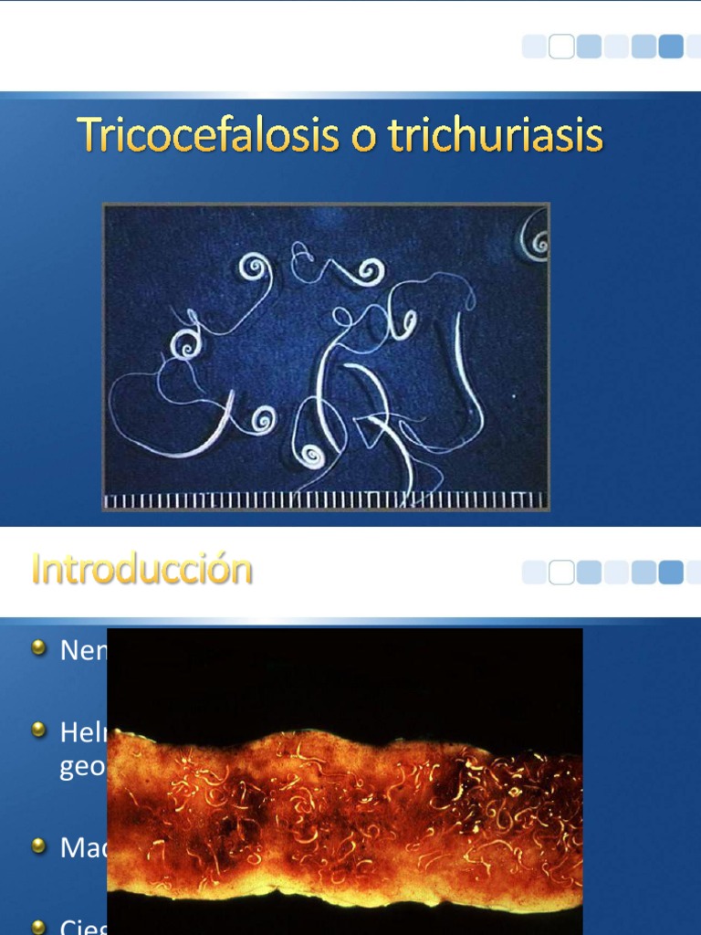 Tricocefalosis o Trichuriasis | PDF