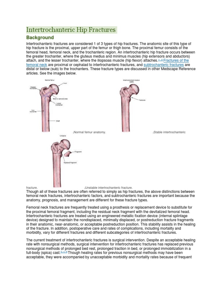 Intertrochanteric Fracture | PDF | Surgery | Hip