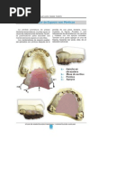 Tipos de Expansores en Ortodoncia | PDF | Ortodoncia | Ramas de Odontología