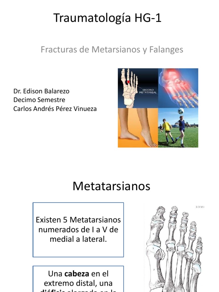 Fx Metatarsianos y Falanges | Pie | Extremidades (Anatomía)