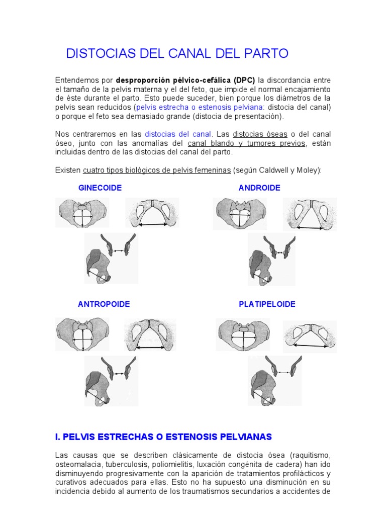 Distocias Del Canal Del Parto | PDF | Pelvis | Parto
