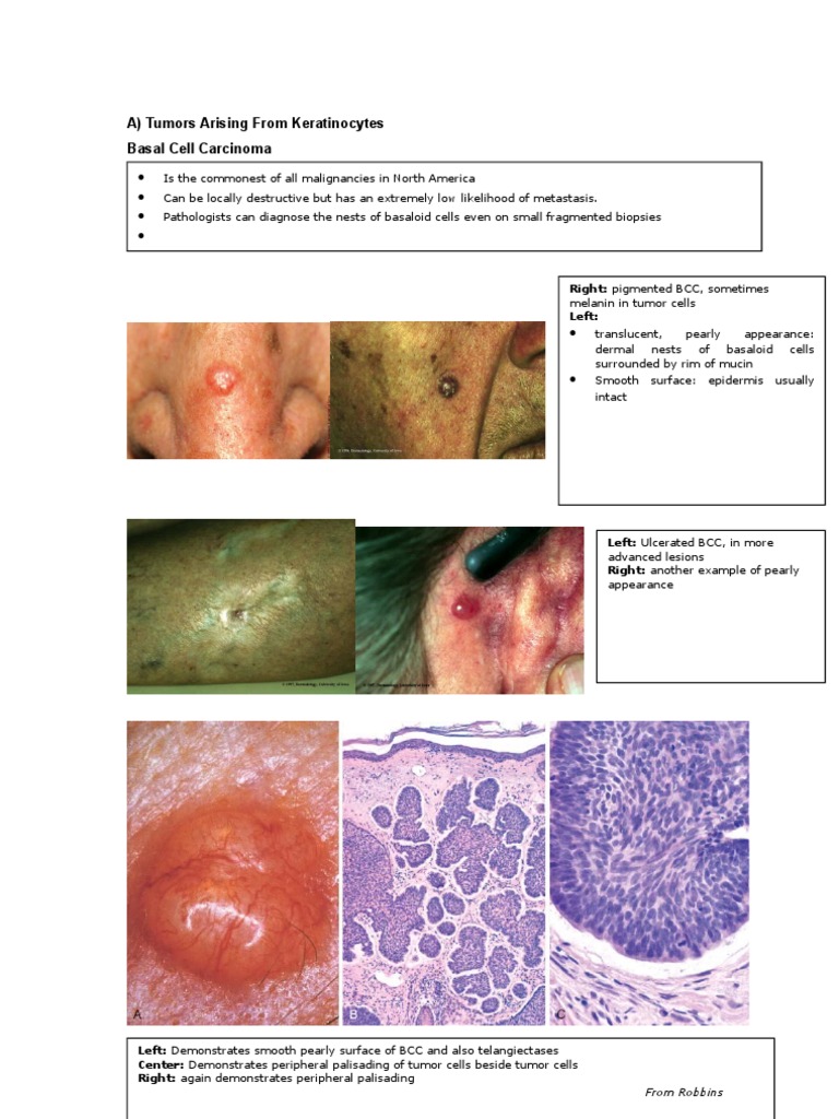 Pathology of Common Skin Diseases With Clinical Correlates | PDF ...