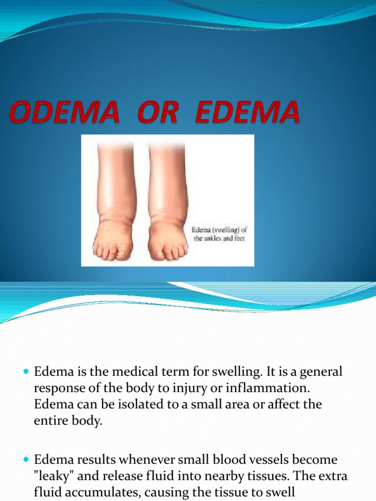 Odema or Edema | PDF | Edema | Health Sciences