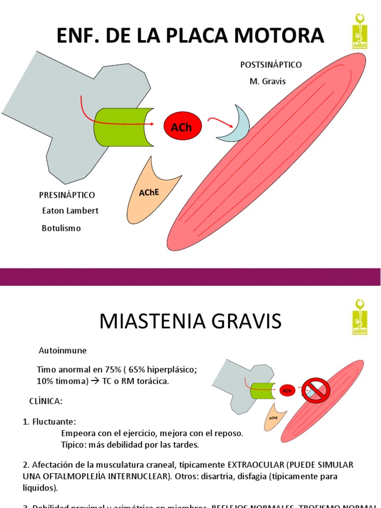 Placa Motora | PDF | Especialidades Medicas | Enfermedades y trastornos