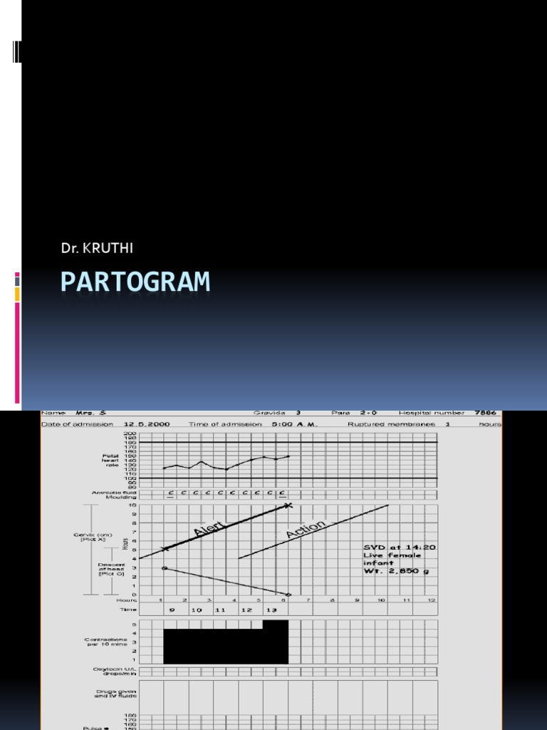 PARTOGRAM | PDF | Maternal Health | Childbirth