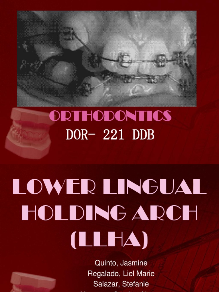 Lower Lingual Holding Arch Overview | PDF | Tooth | Dentistry Branches