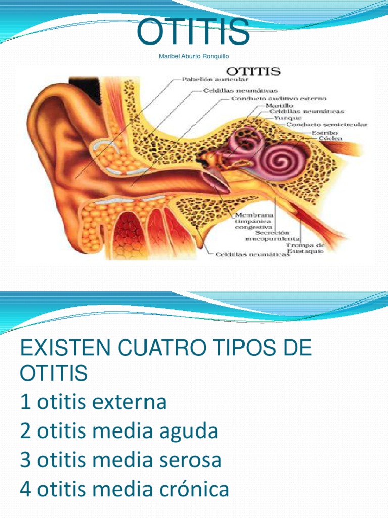 Otitis | PDF