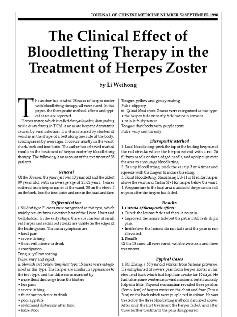 Treatment of Herpes Zoster | Traditional Chinese Medicine | Herpes Simplex