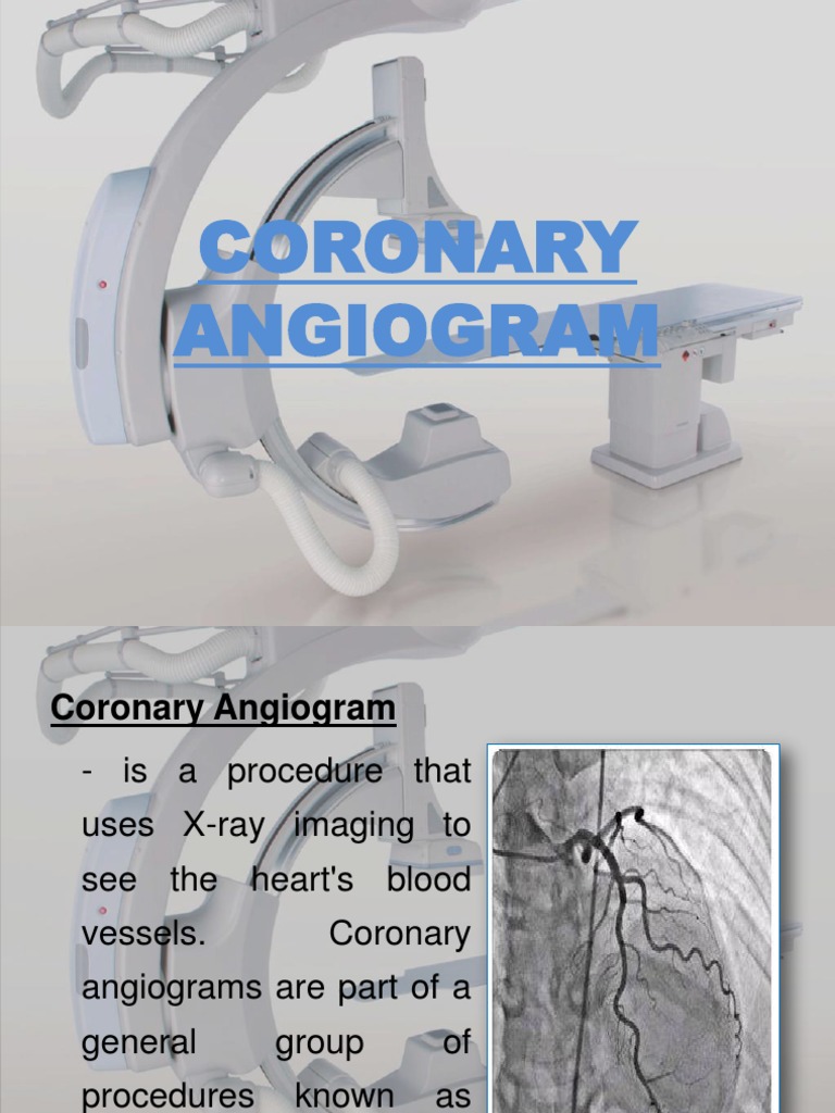 Coronary Angiogram | PDF