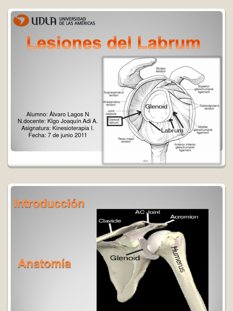 Lesiones Del Labrum | PDF | Hombro | Rodilla