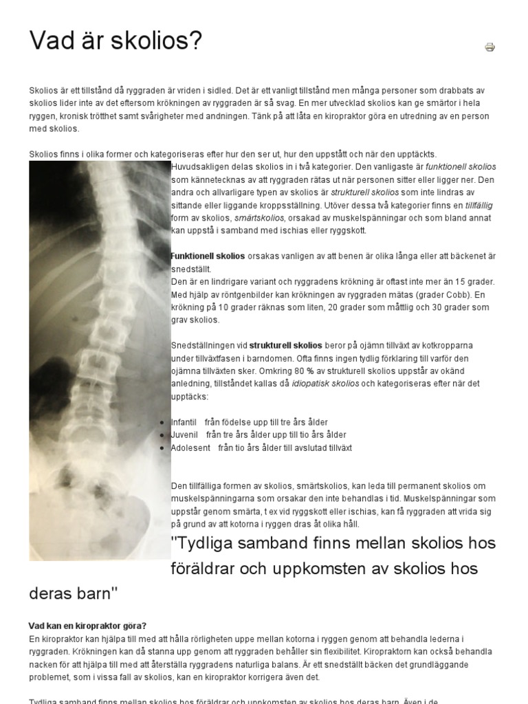 Vad Är Skolios | PDF