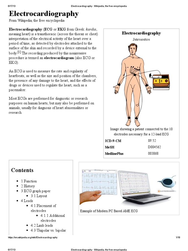 Electrocardiography - Wikipedia, The Free Encyclopedia | PDF ...