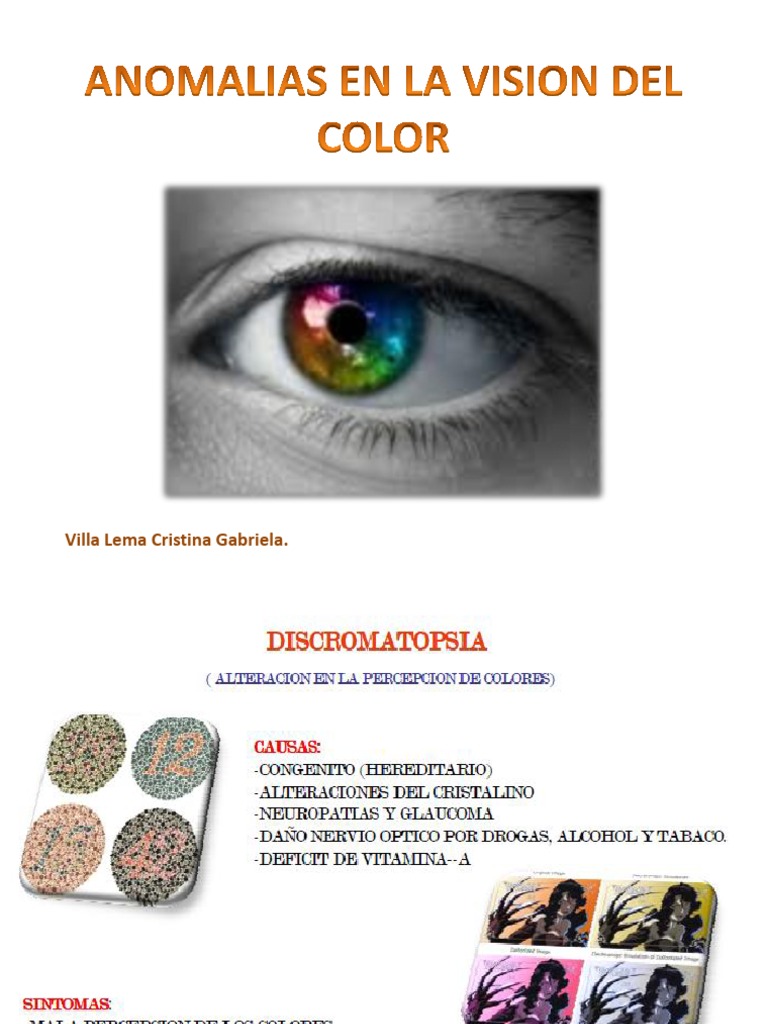 DISCROMATOPSIAS | PDF | Visión | Color