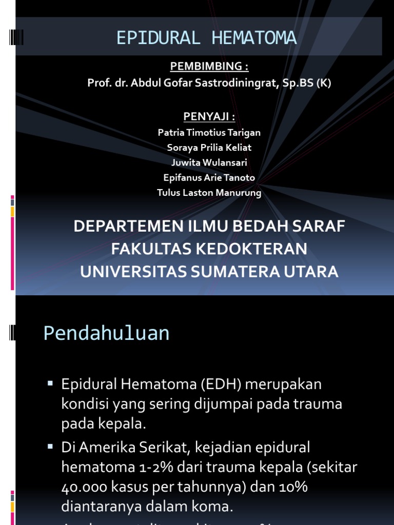 Epidural Hematoma Ppt
