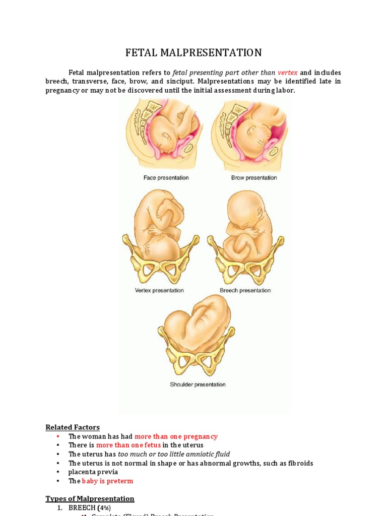 Fetal Malpresentation | PDF | Childbirth | Caesarean Section