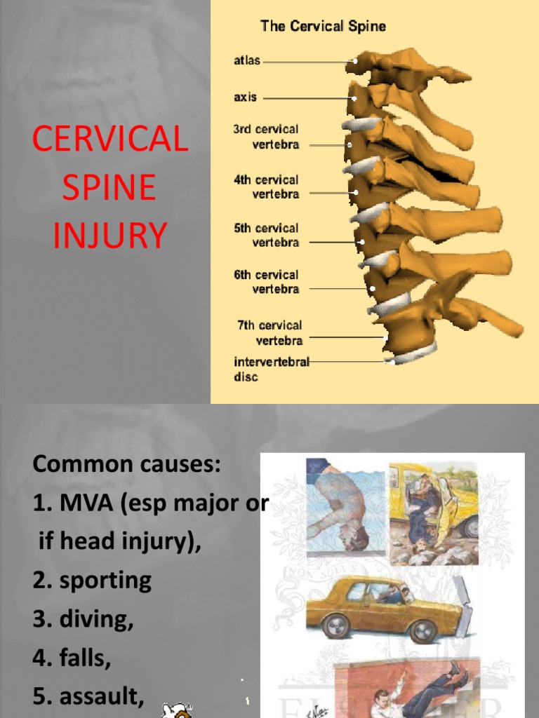 Cervical Spine Injury | PDF | Vertebra | Vertebral Column