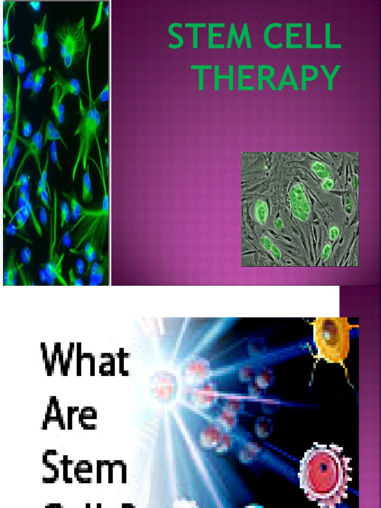 Stem Cell Therapy | PDF | Cell Potency | Stem Cell