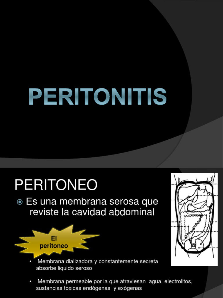 Peritonitis - PPTX Final | PDF | Especialidades Medicas | Abdomen
