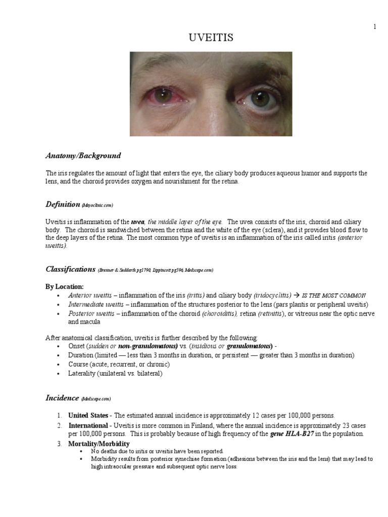 14 - Uveitis | PDF | Ophthalmology | Epidemiology