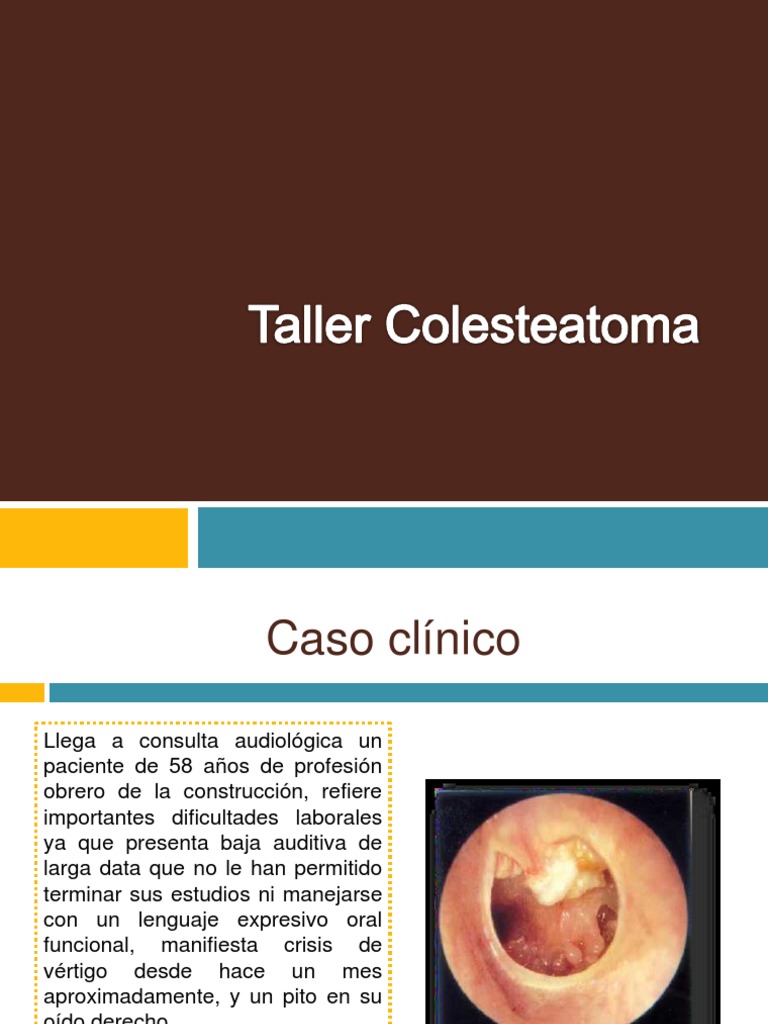 Taller Colesteatoma | Especialidades médicas | Medicina clínica