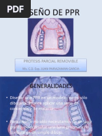 Línea de Fulcro en Prótesis Removible | PDF | Dentadura postiza ...