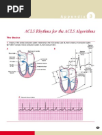 ICU One Pager External Pacemakers v11 | PDF | Artificial Cardiac ...