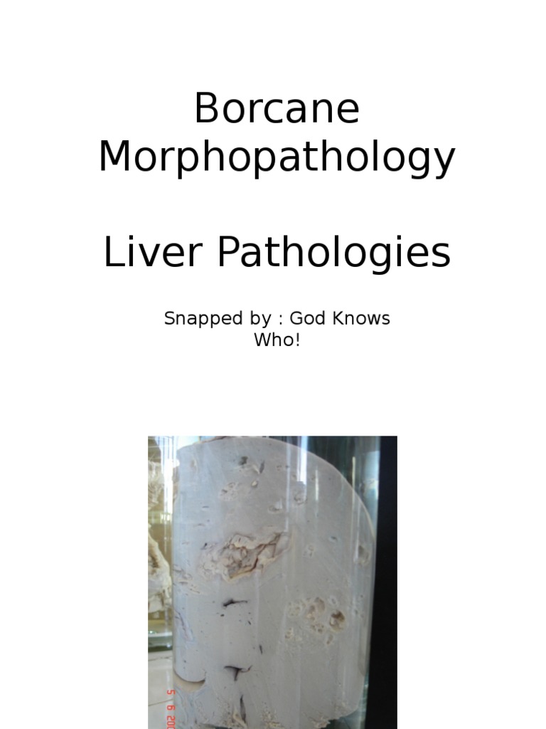 Borcane Morphopathology Liver Pathologies: Snapped By: God Knows Who ...