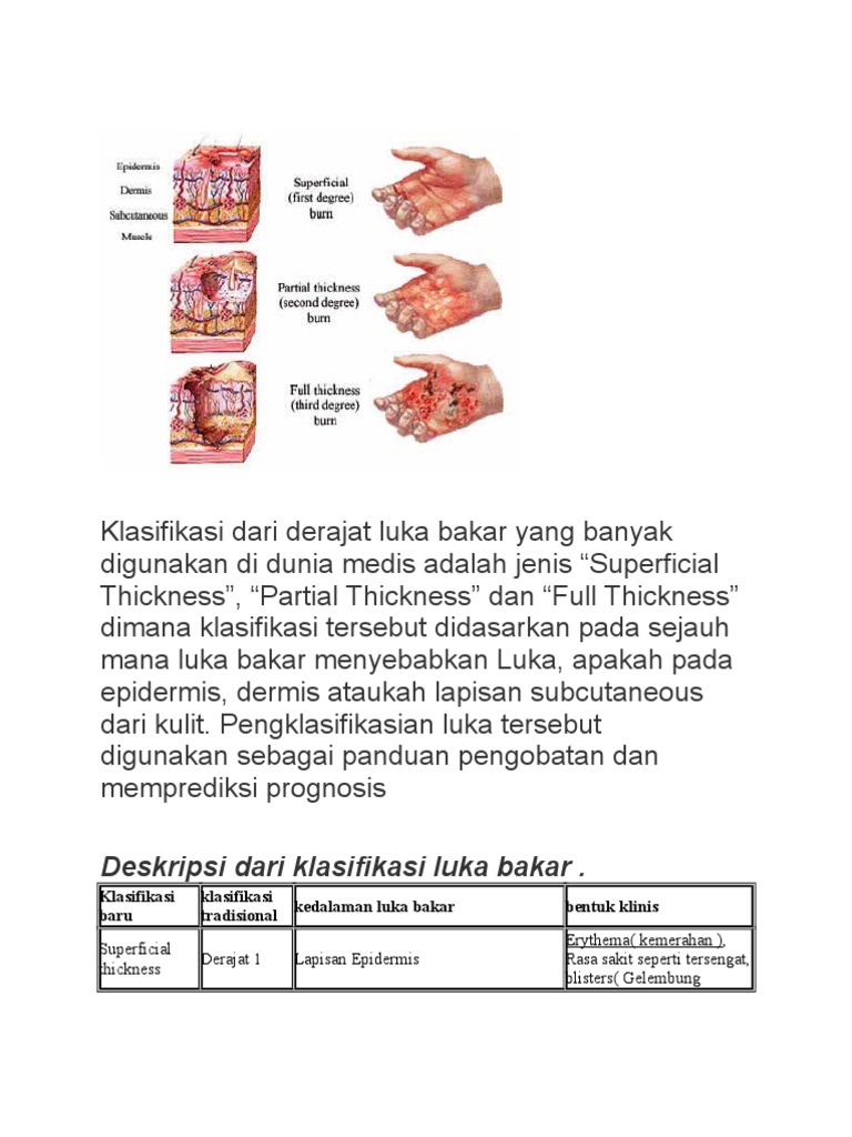 Klasifikasi Dari Derajat Luka Bakar Yang Banyak Digunakan Di Dunia Medis Adalah Jenis | PDF