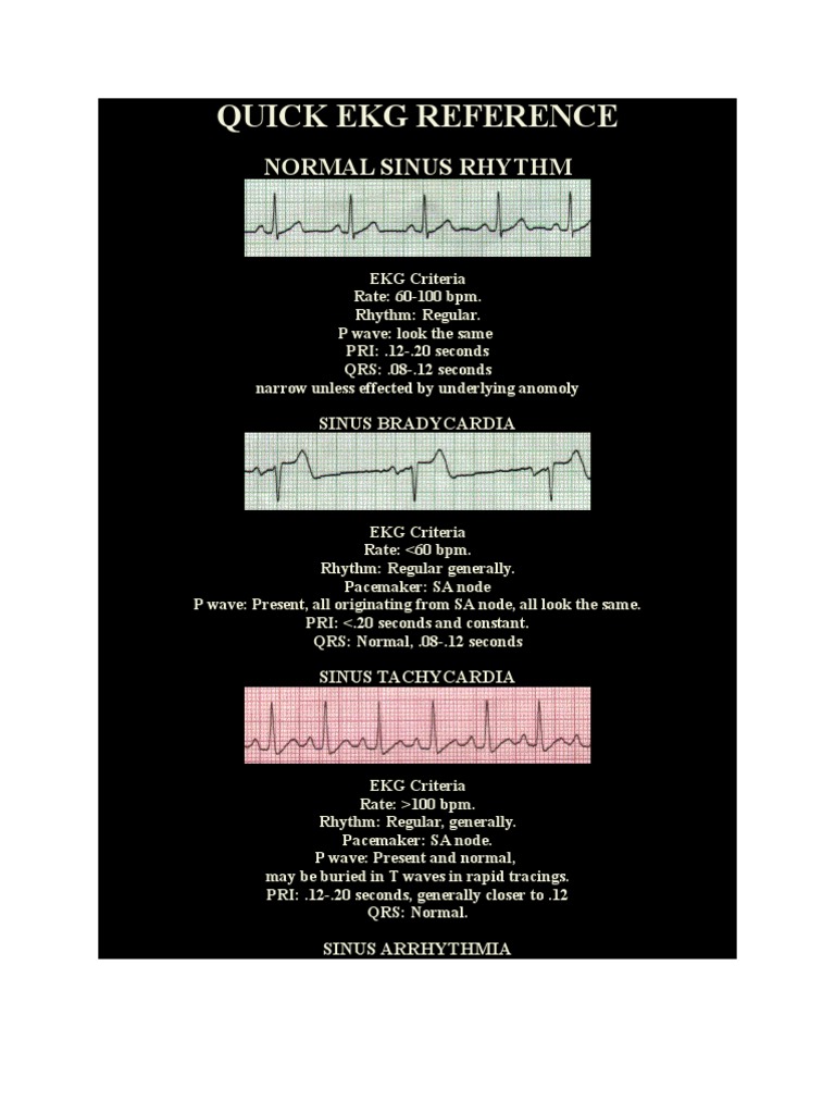 Quick Ekg Reference | Download Free PDF | Electrocardiography ...