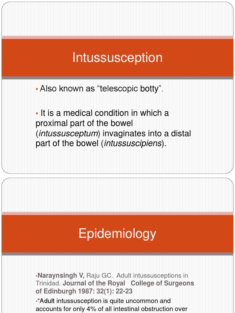 Intussusception: A Comprehensive Review of Epidemiology, Pathogenesis ...