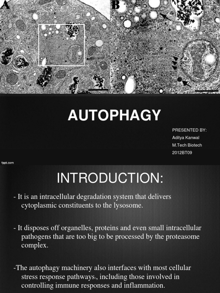 Autophagy.ppt | Autophagy | T Cell