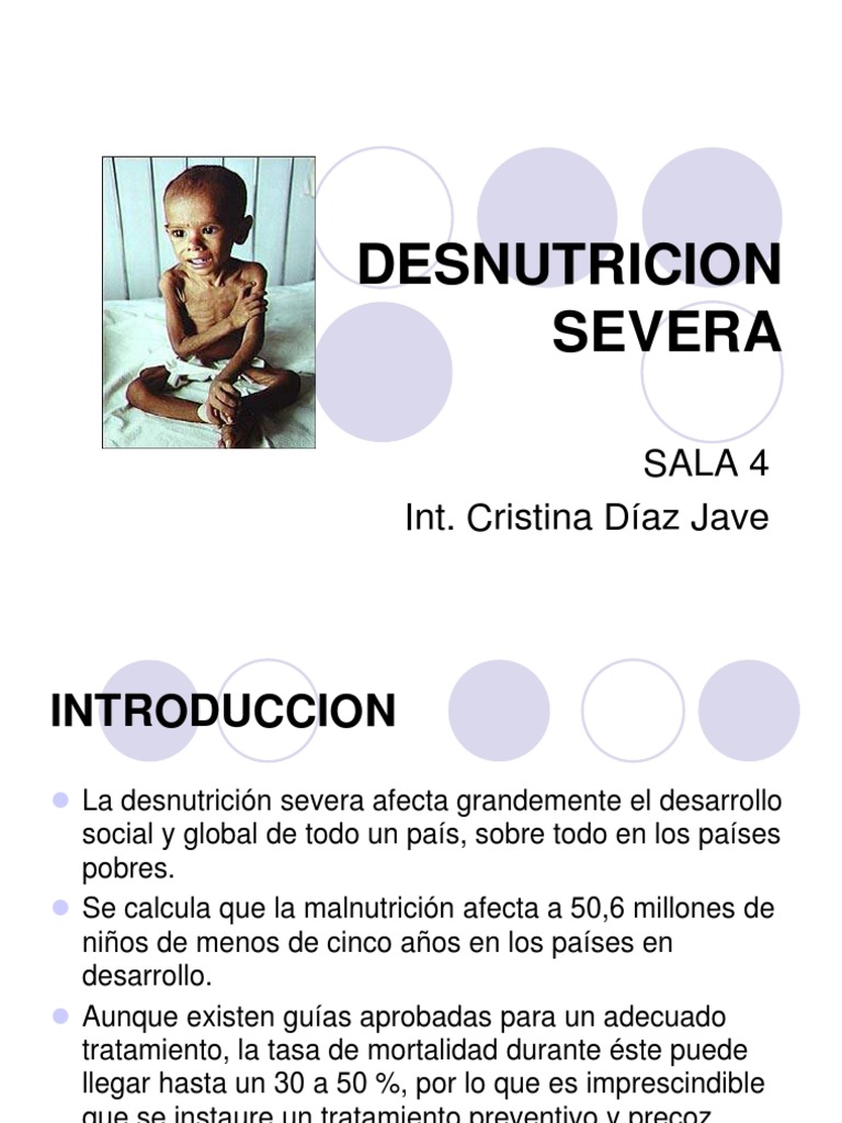 Desnutrición Severa en Niños Menores de 5 Años | PDF | Proteínas ...
