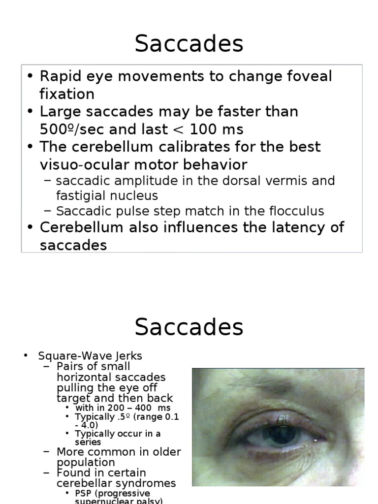 Nki Saccade | PDF | Cerebellum | Neurology