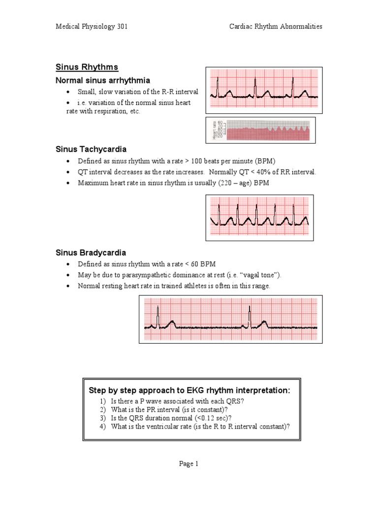 EKG Rhythms2 PDF | PDF | Heart Rate | Cardiac Arrhythmia
