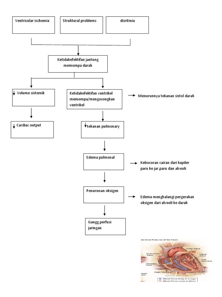 Pathway Syok Kardiogenik | PDF