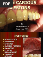 Cavosurface Margin Treatment Guide | PDF | Tooth Enamel | Tooth