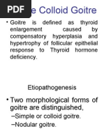 Goiter