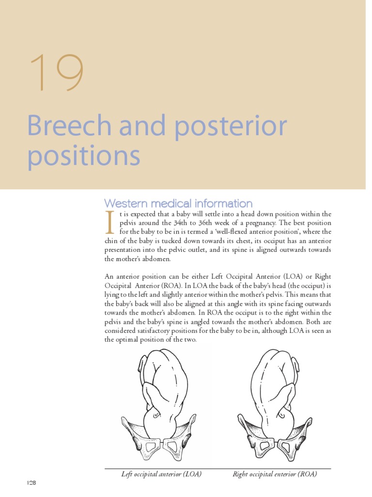 Breech and Posterior Positions: Western Medical Information | PDF ...