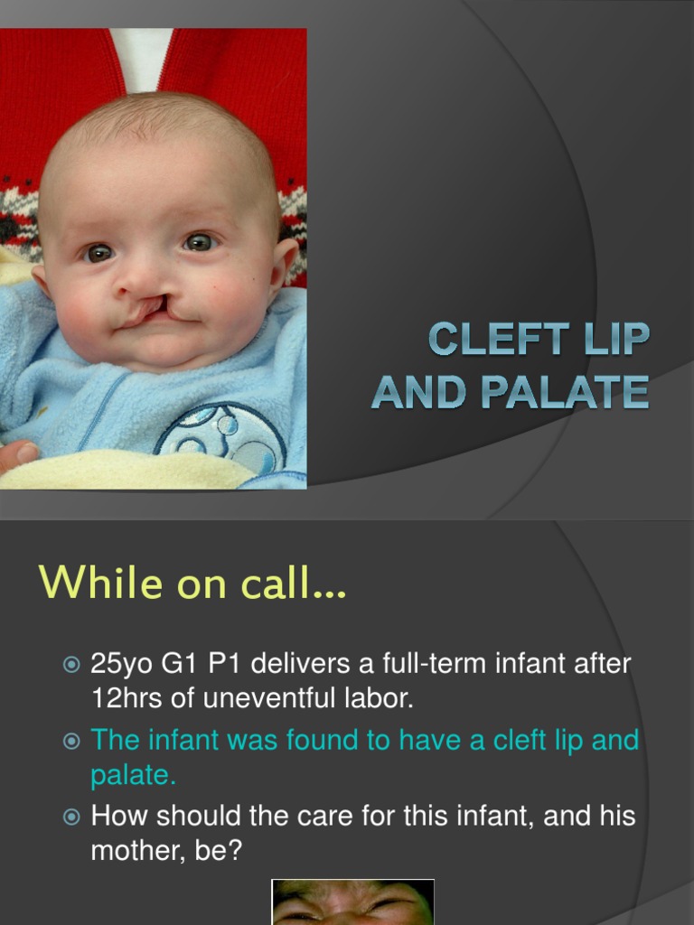 Cleft Lip Palate | PDF | Face | Facial Features